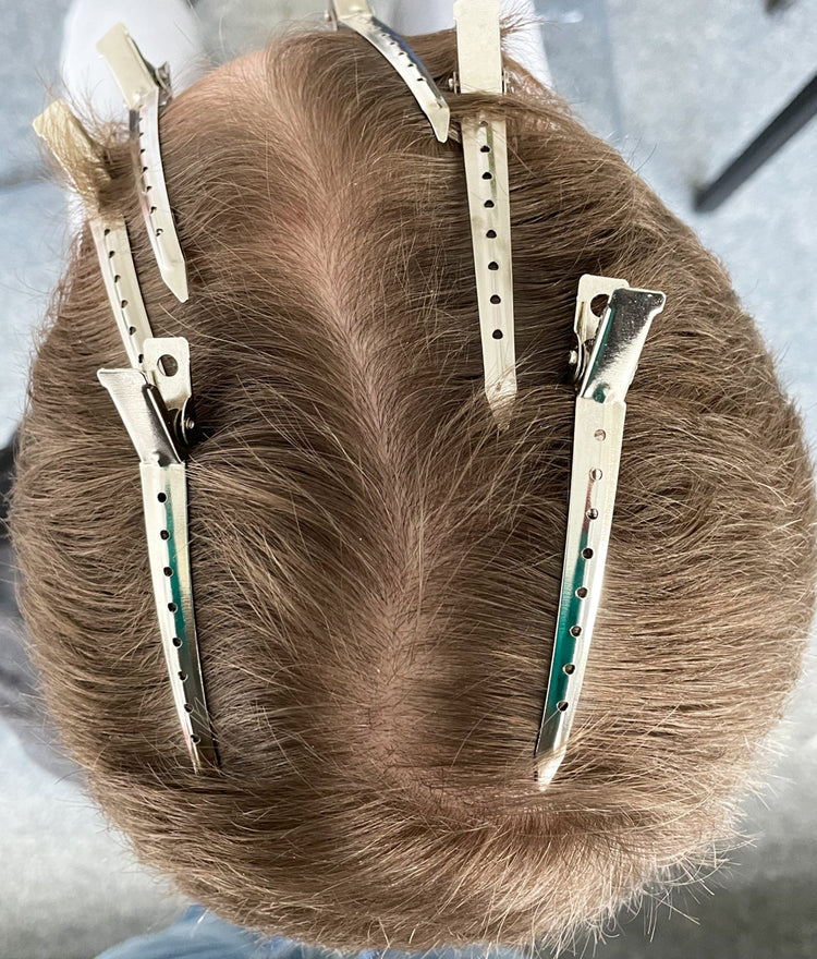 niostem - Wearable technology for hair re-growth